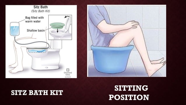 Sitz Bath procedure | PPTX