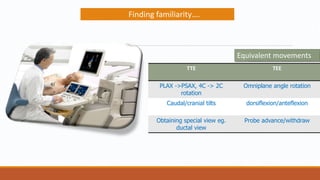 Transesophageal echocardiography | PPTX