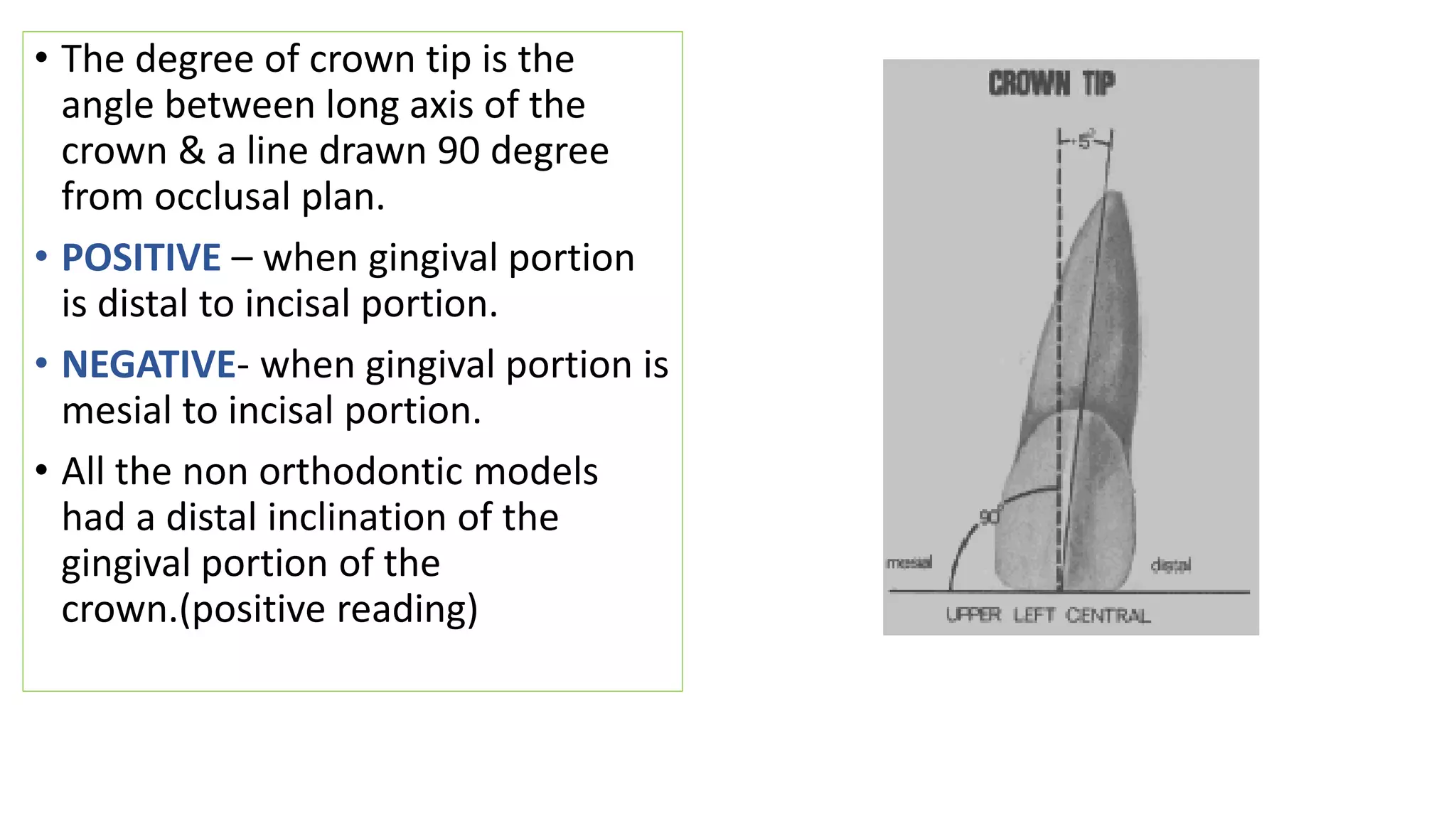 Andrews Six key of occlusion | PPTX