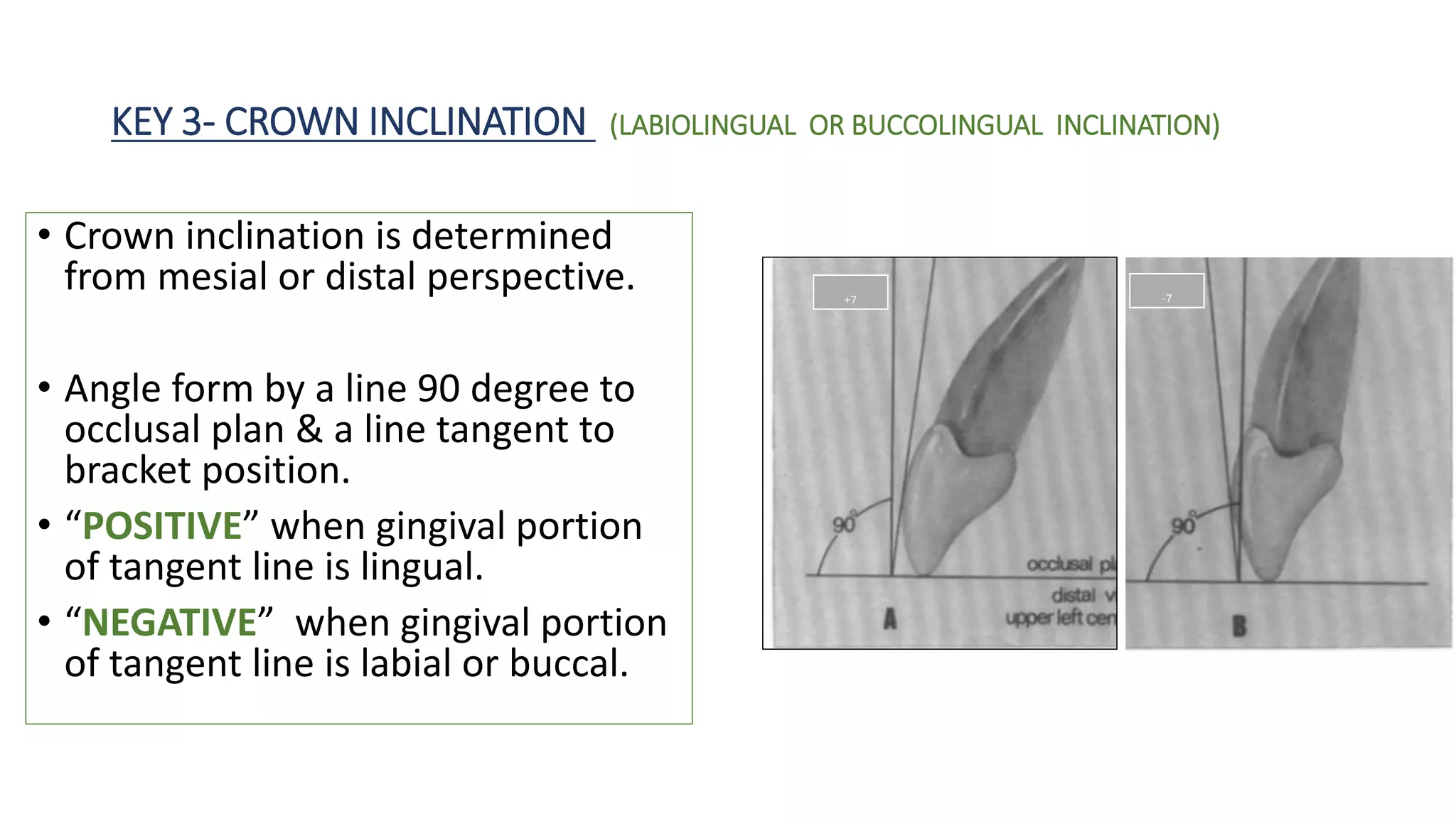 Andrews Six key of occlusion | PPTX