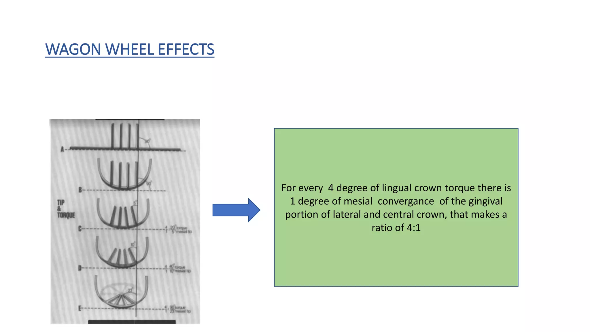 Andrews Six key of occlusion | PPTX