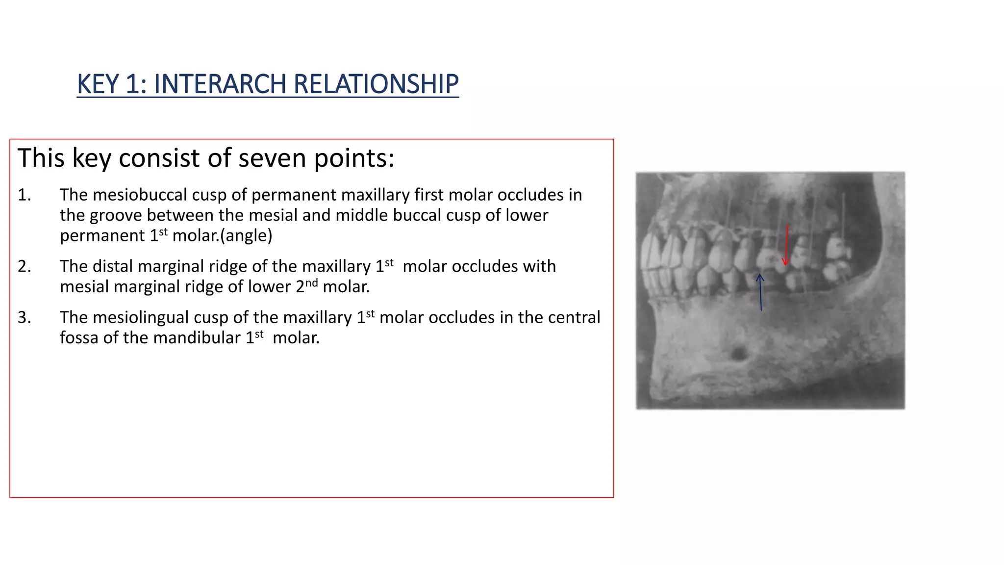 Andrews Six key of occlusion | PPTX