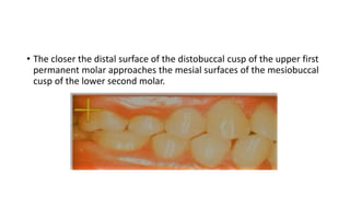 Andrews Six key of occlusion | PPTX