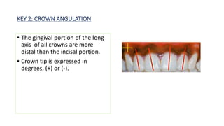Andrews Six key of occlusion | PPTX