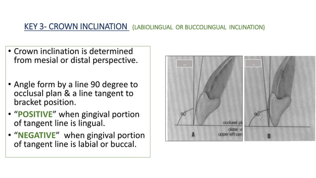 Andrews Six key of occlusion | PPTX