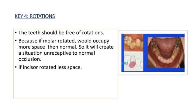 Andrews Six key of occlusion | PPTX