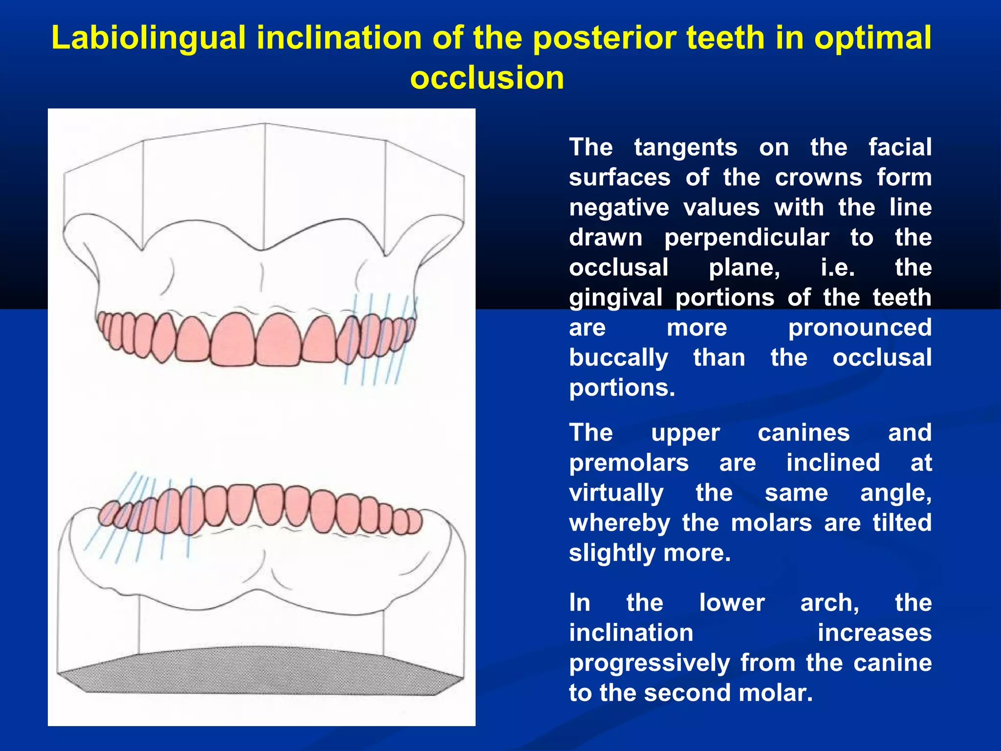 Six keys of normal occlusion - Dr. Maher Fouda | PPT | Dental Health ...