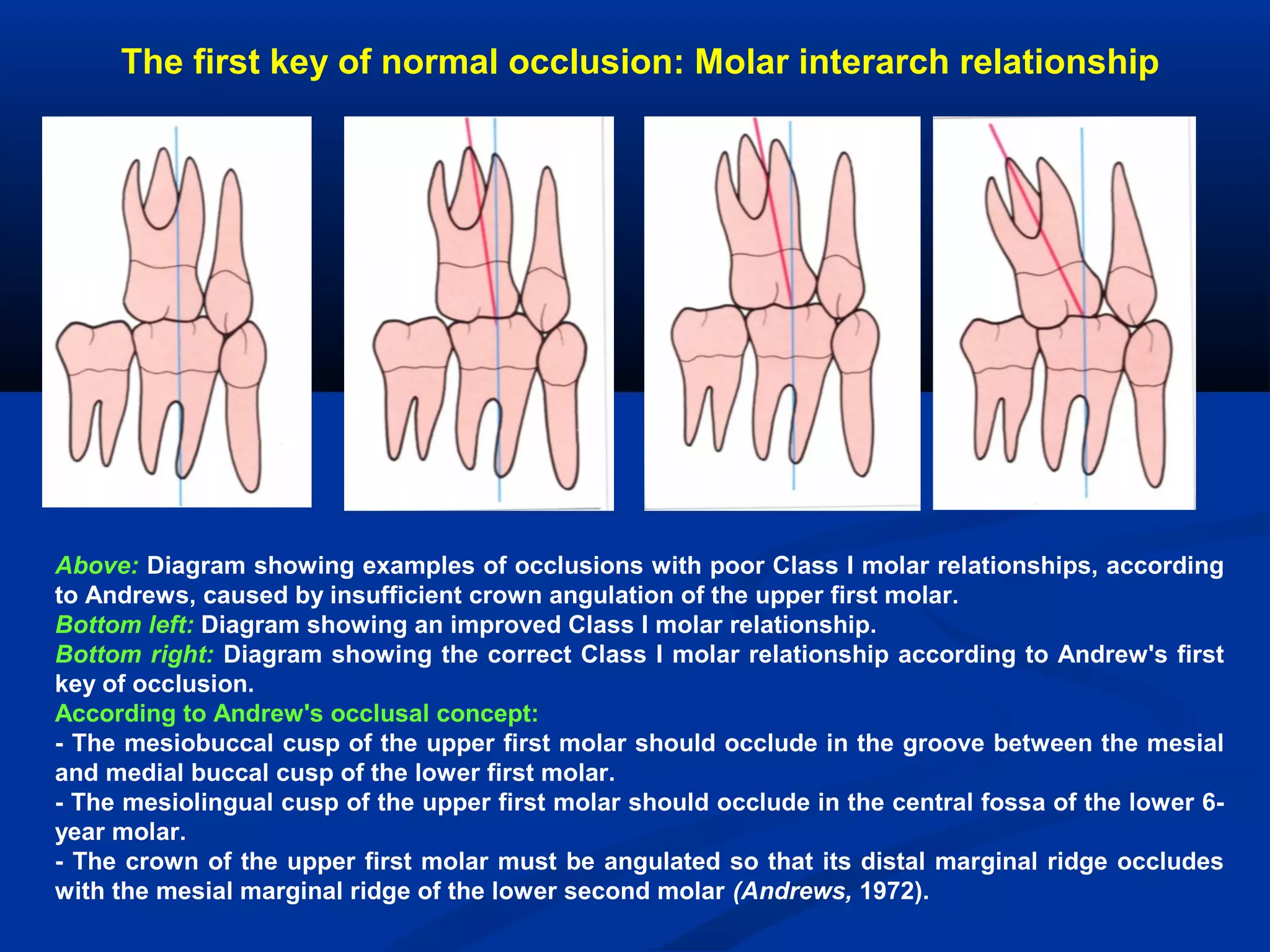 Six keys of normal occlusion - Dr. Maher Fouda | PPT