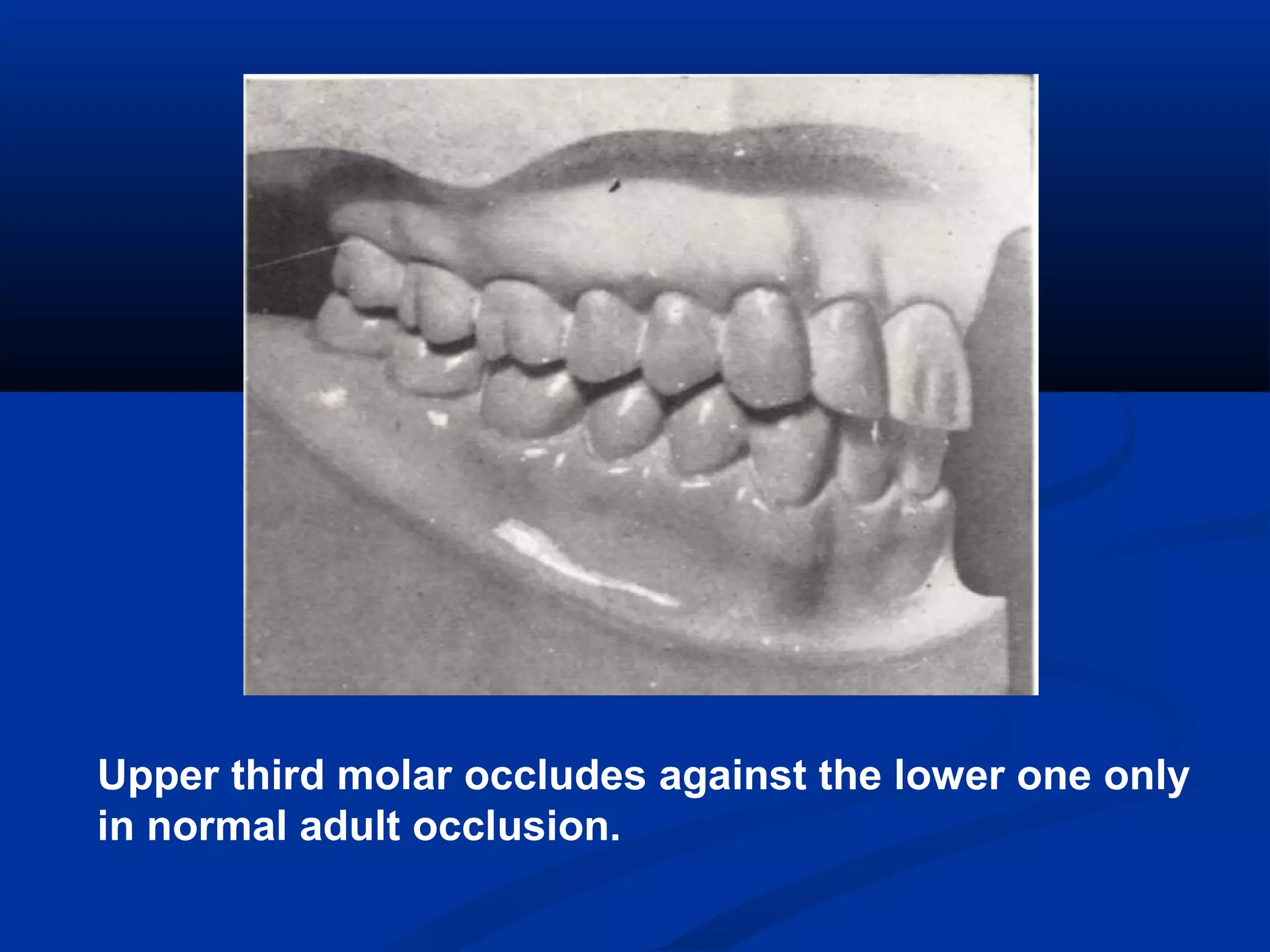 Six keys of normal occlusion - Dr. Maher Fouda | PPT