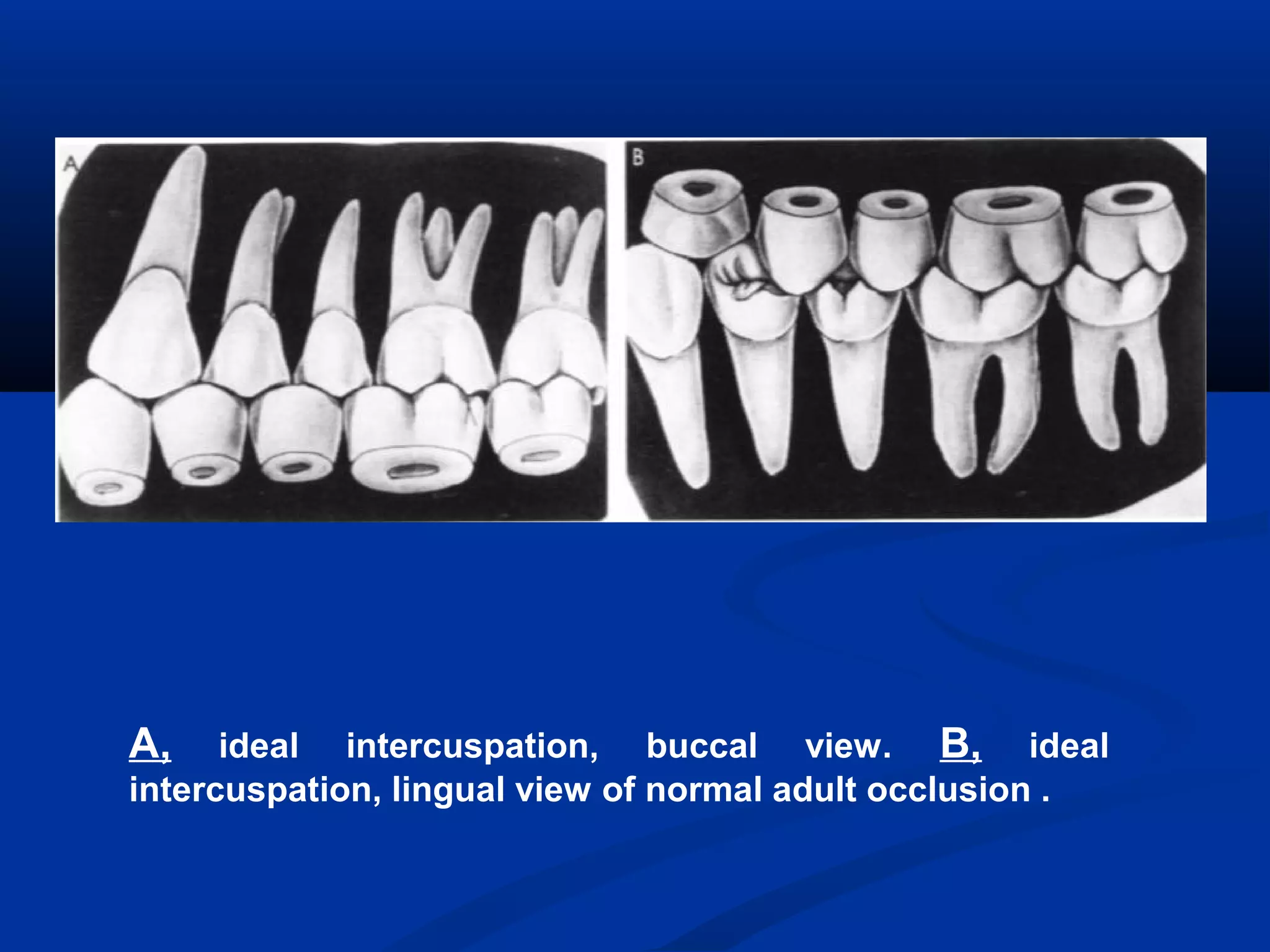 Six keys of normal occlusion - Dr. Maher Fouda | PPT
