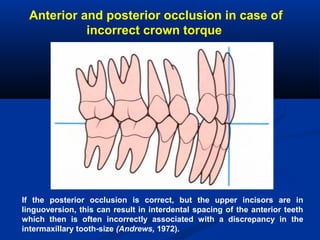 Six keys of normal occlusion - Dr. Maher Fouda | PPT
