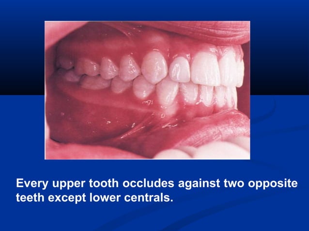 Six keys of normal occlusion - Dr. Maher Fouda | PPT | Dental Health ...
