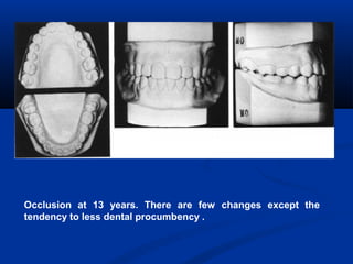 Six keys of normal occlusion - Dr. Maher Fouda | PPT
