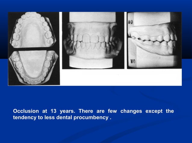 Six keys of normal occlusion - Dr. Maher Fouda | PPT | Dental Health ...