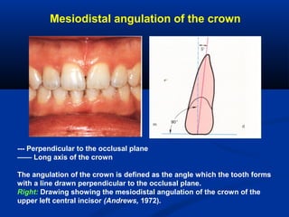 Six keys of normal occlusion - Dr. Maher Fouda | PPT