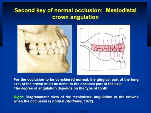 Six keys of normal occlusion - Dr. Maher Fouda | PPT | Dental Health ...