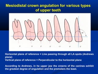Six keys of normal occlusion - Dr. Maher Fouda | PPT