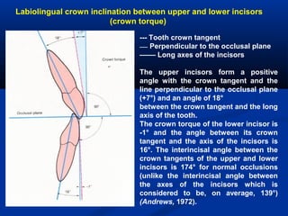 Six keys of normal occlusion - Dr. Maher Fouda | PPT