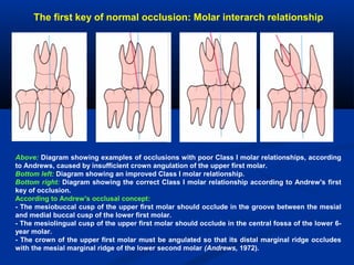 Six keys of normal occlusion - Dr. Maher Fouda | PPT