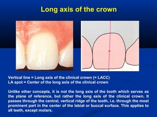 Six keys of normal occlusion - Dr. Maher Fouda | PPT