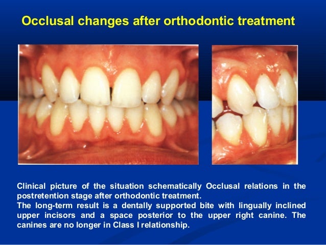 Six keys of normal occlusion - Dr. Maher Fouda