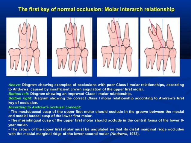Six keys of normal occlusion - Dr. Maher Fouda