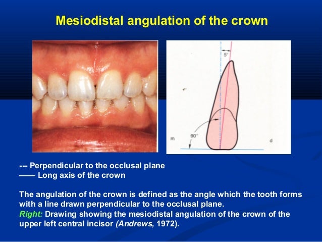 Six keys of normal occlusion - Dr. Maher Fouda