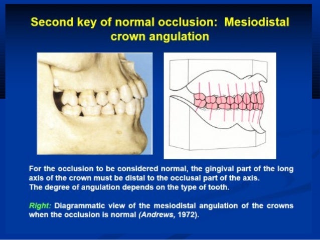 Six keys of normal occlusion - Dr. Maher Fouda
