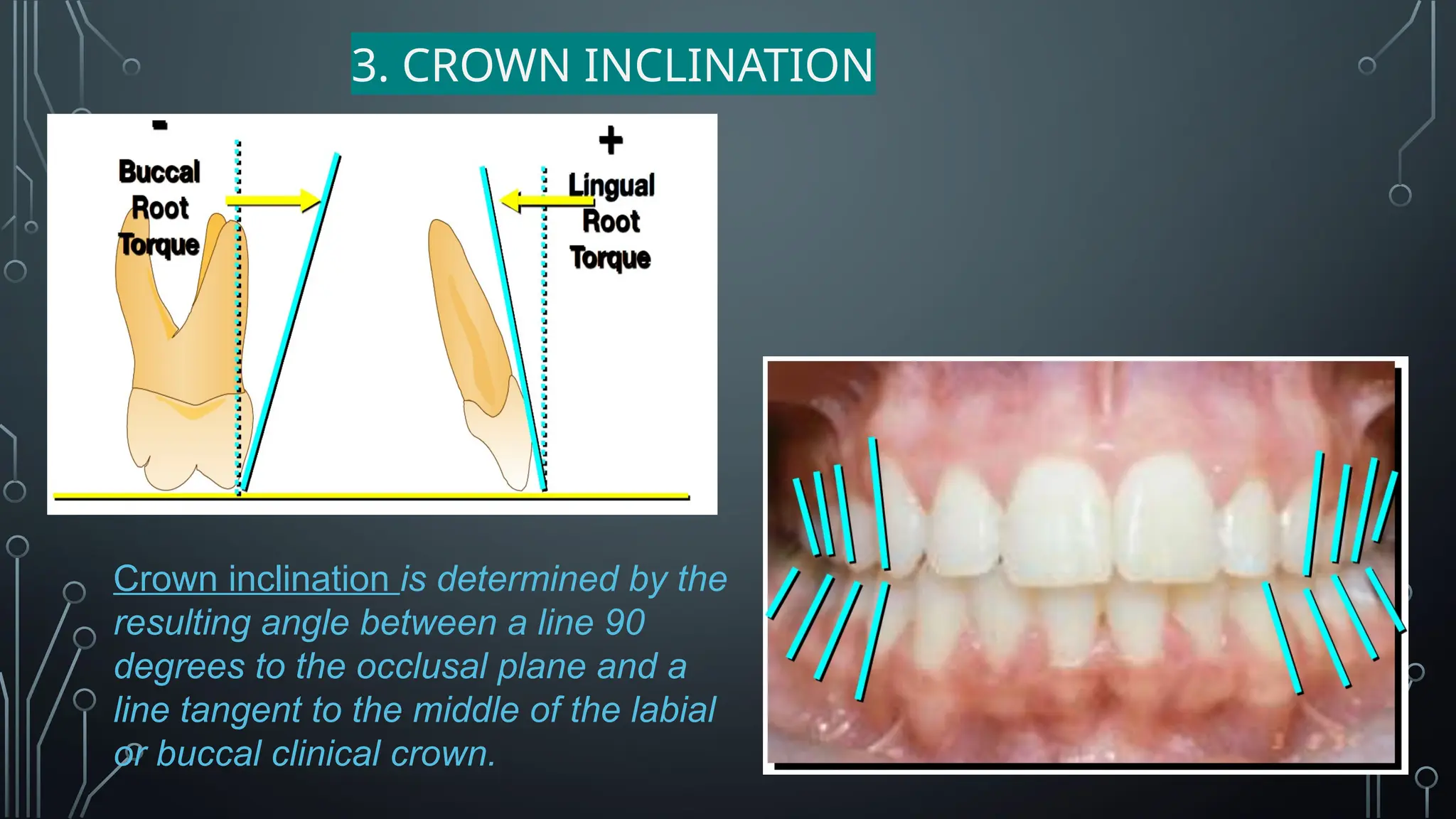 THE SIX KEYS TO NORMAL OCCLUSION seminar.pptx