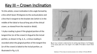 ANDREWS SIX KEYS TO OCCLUSION by Dr. L.F. Andrews | PPTX