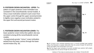 ANDREWS SIX KEYS TO OCCLUSION by Dr. L.F. Andrews | PPTX