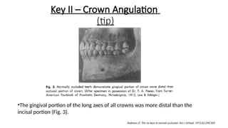 ANDREWS SIX KEYS TO OCCLUSION by Dr. L.F. Andrews | PPTX