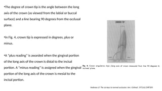 ANDREWS SIX KEYS TO OCCLUSION by Dr. L.F. Andrews | PPTX