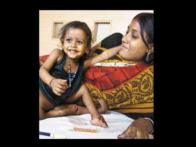 Six limbed child lakshmi | PPT