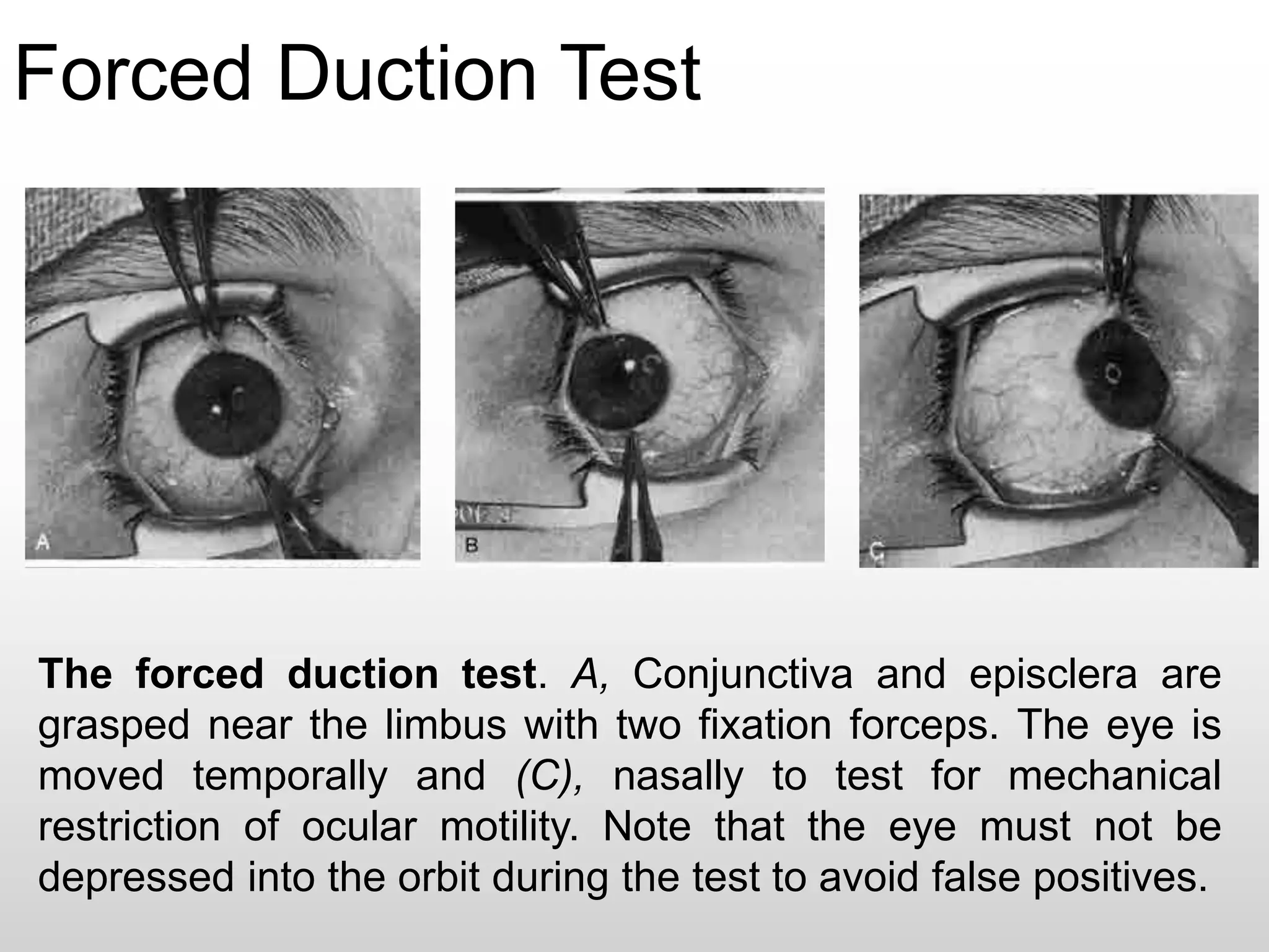 Sixth and seventh cranial nerves: anatomy and disorders | PPTX
