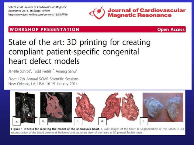 Siyanotik kongenital kalp hastaliklari genel tanimlar dr. yusuf kenan ...