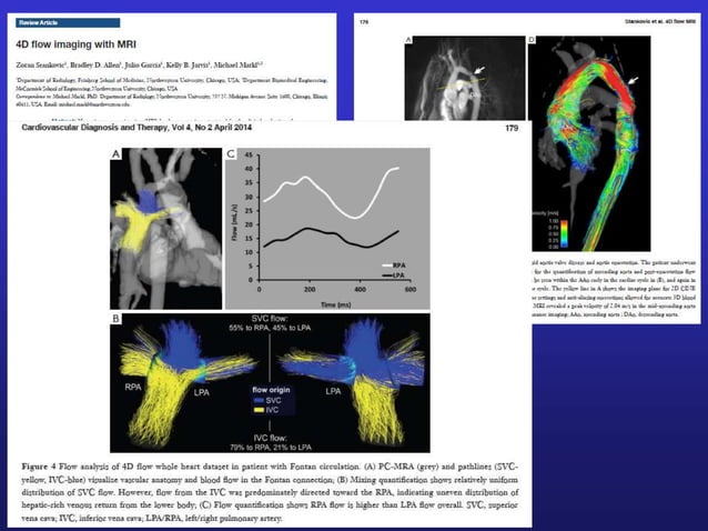 Siyanotik kongenital kalp hastaliklari genel tanimlar dr. yusuf kenan ...