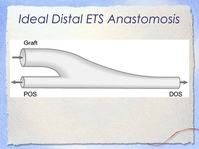 Size of anastomosis | PPT