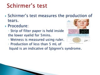 Sjögren's syndrome | PPTX