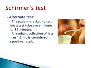 Sjögren's syndrome | PPTX