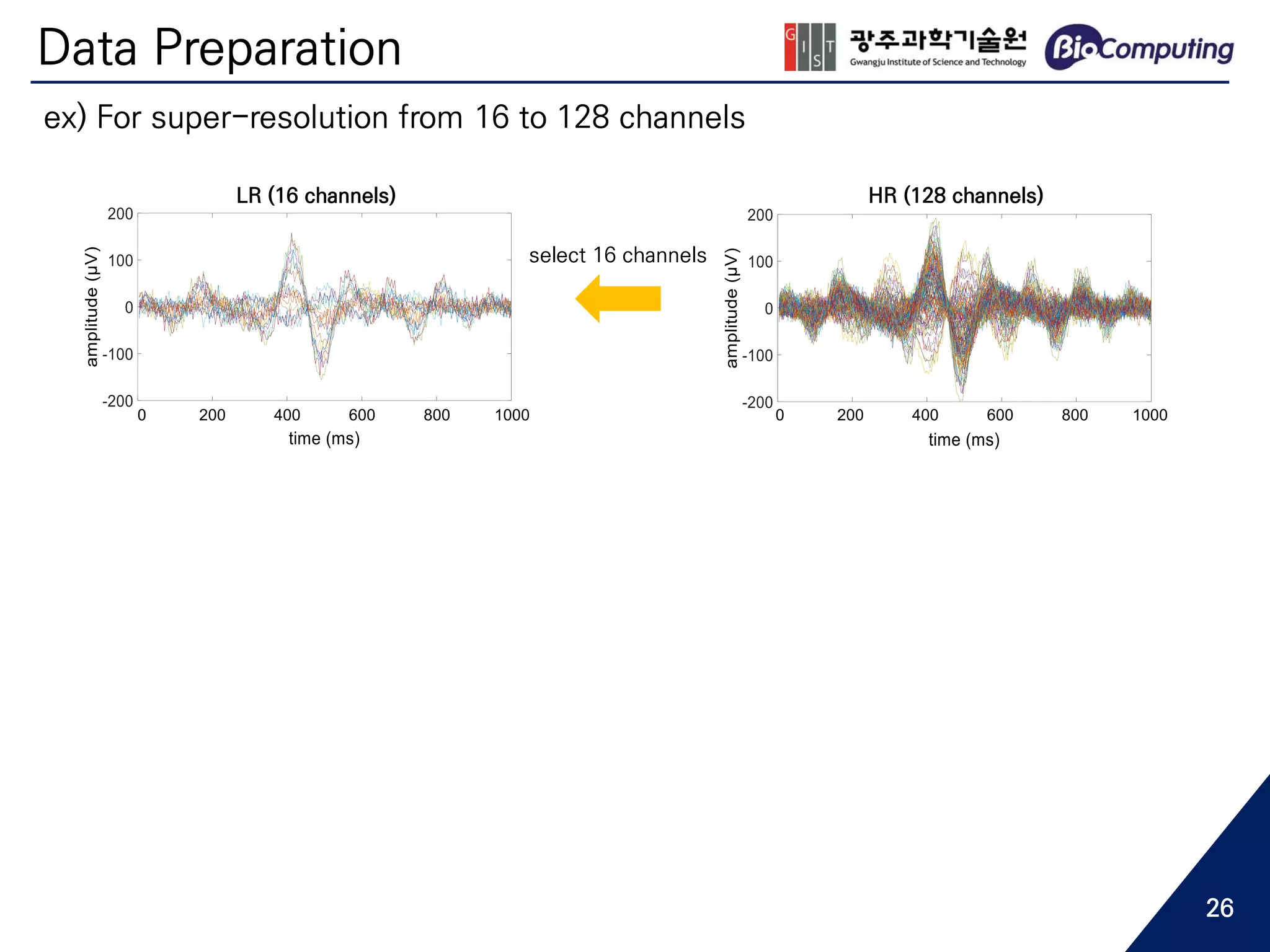 Feasibility Of Eeg Super Resolution Using Deep Convolutional Networks Ppt