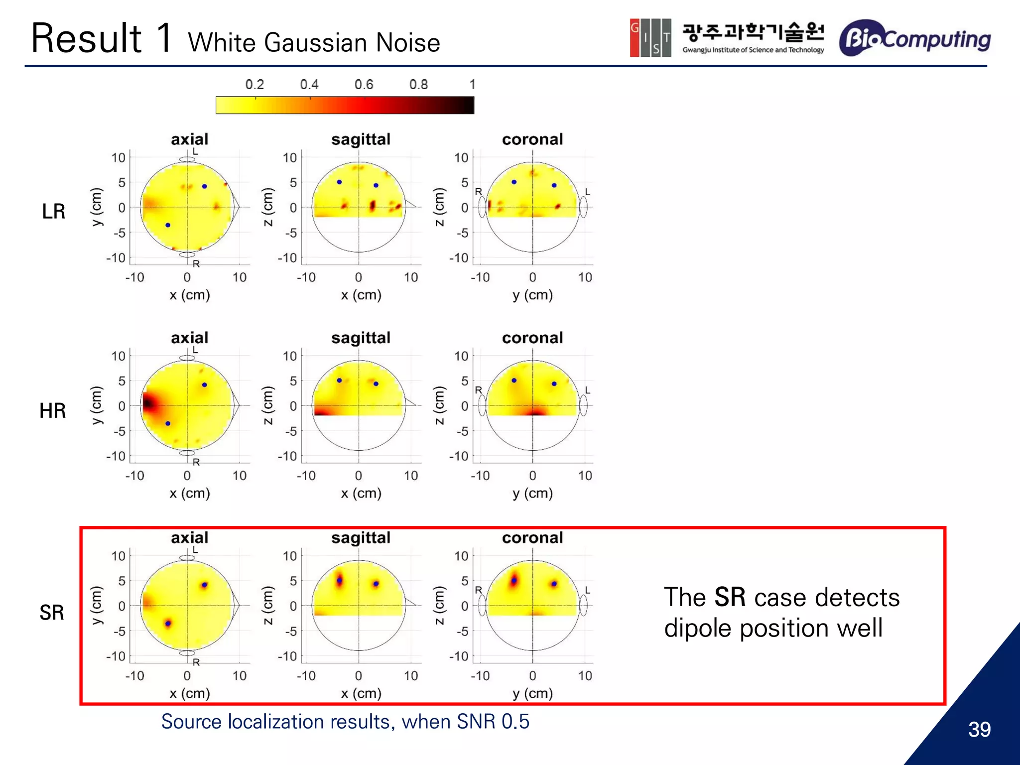 Feasibility Of Eeg Super Resolution Using Deep Convolutional Networks Ppt