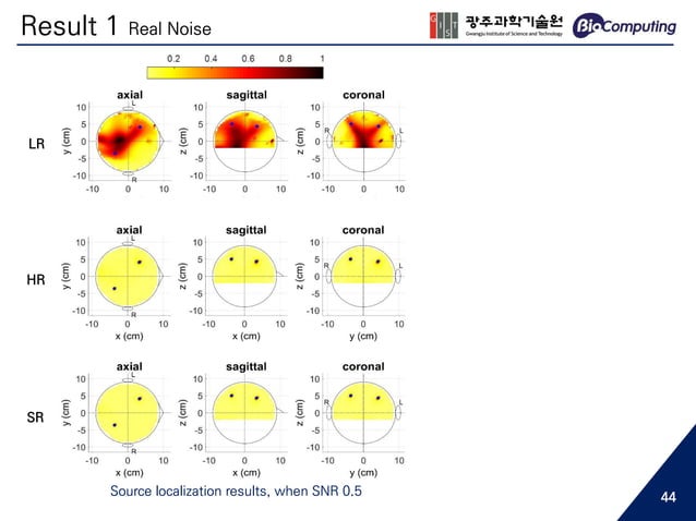 Feasibility of EEG Super-Resolution Using Deep Convolutional Networks | PPT