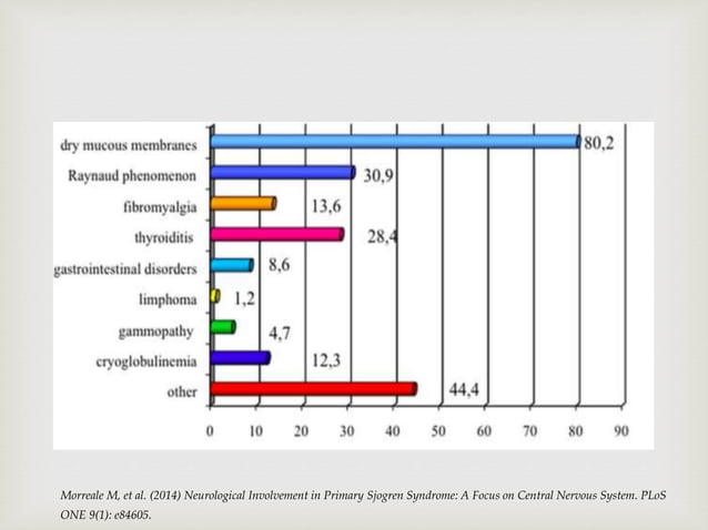 Sjogren Syndrome- a complex CNS disease | PPT