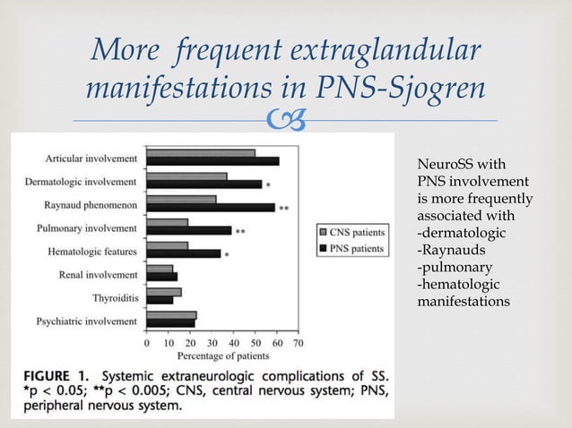 Sjogren Syndrome- a complex CNS disease | PPT