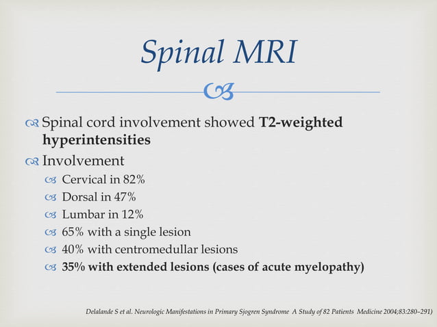 Sjogren Syndrome- a complex CNS disease | PPT