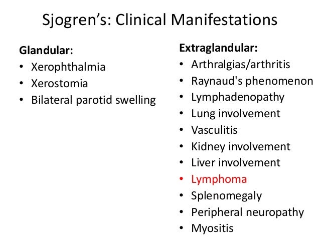 Sjogren's syndrome