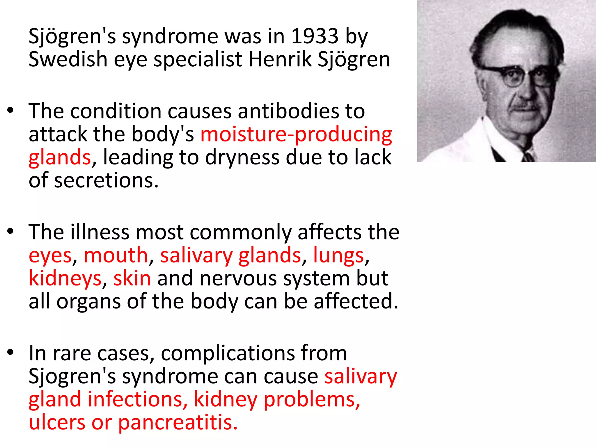Sjogren's syndrome | PPTX