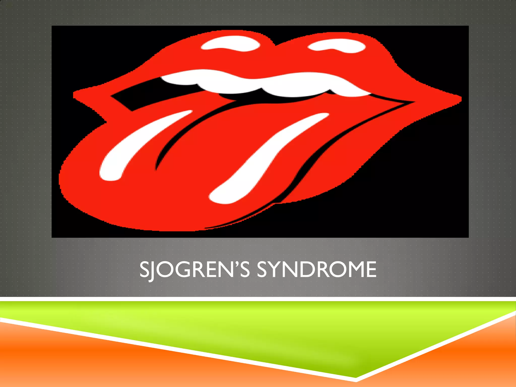 Sjogren’s syndrome | PDF