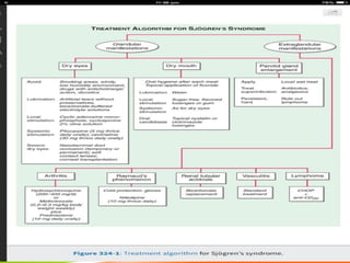 Sjogren’s syndrome | PDF